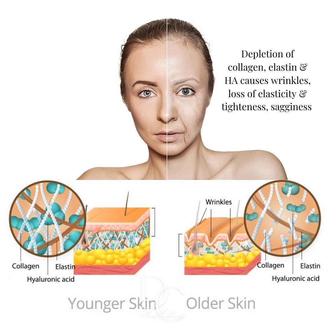 Why my skin looks more saggy, dry and wrinkly? DC Aesthetics