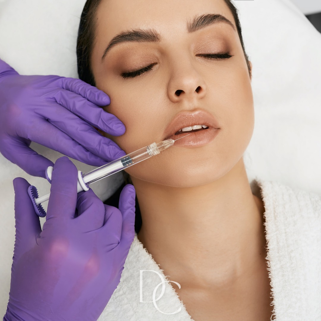 Most common questions about lip filler treatment | DC Aesthetics